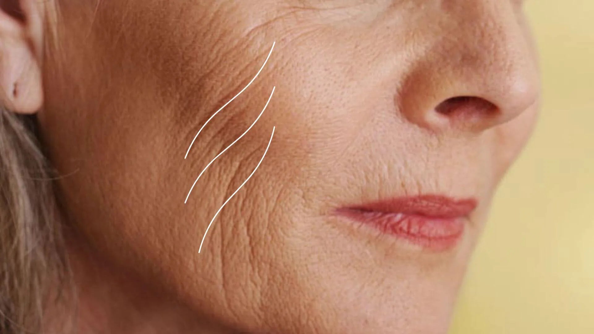 Når får man rynker? – Beauty Mall